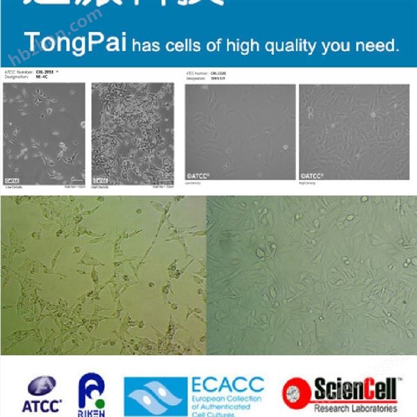 LLC细胞形态 LLC小鼠肺癌细胞 细胞株类-通派（上海）生物科技有限公司